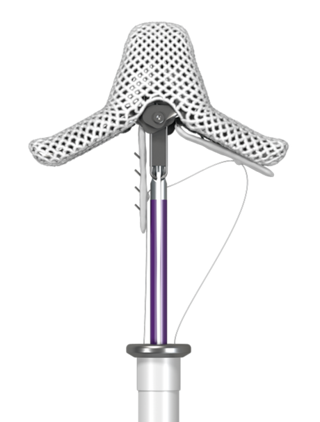 MitraClip G4 Features - Tailored. Optimized. Proven.